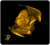 Buy SIUI Ultrasound System Apogee 3300 Neo at lowest price in BD.