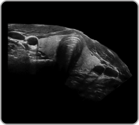 Buy SIUI Ultrasound System Apogee 3300 Neo at lowest price in BD.