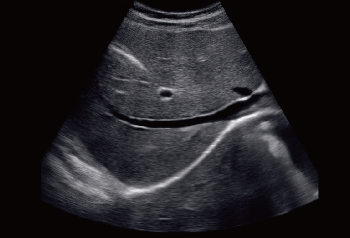 Buy Best Price Chison ECO 2 Portable color Ultrasound in Bangladesh