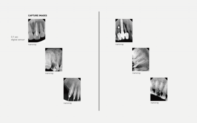 NANORAY NR-F300 Ultra-Light Portable X-Ray Machine - Medistore