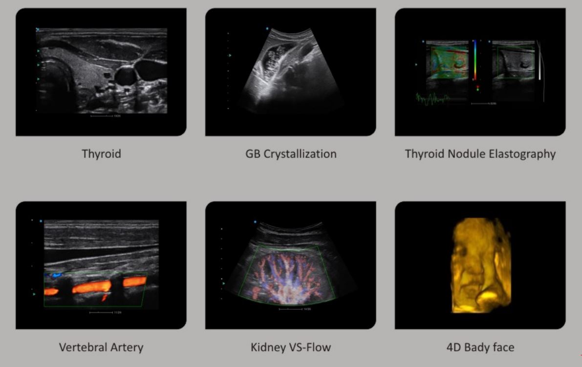 SIUI Apogee 3500 Elite Digital 4D Color Doppler Ultrasound Machine at ...