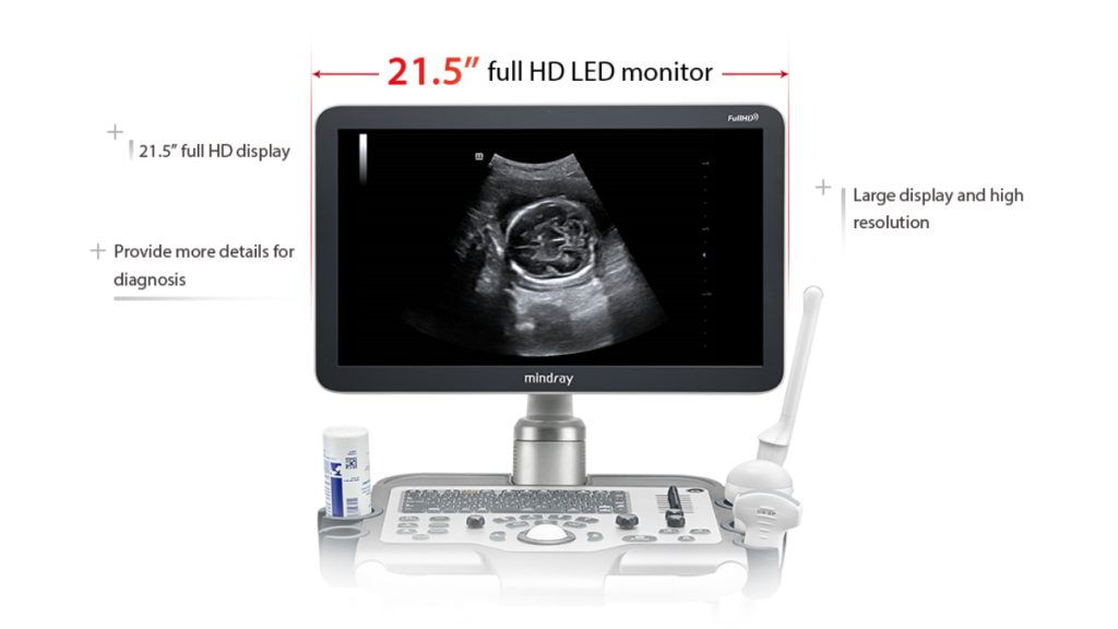 Mindray DC 32 Full HD Ultrasound System - Lowest price in BD