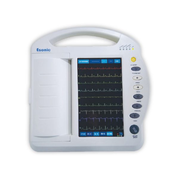 Esonic ECG - 1200C 12 Channel Digital ECG Machine - Medistore
