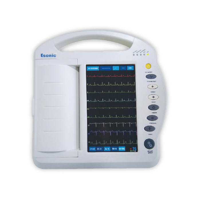 Esonic ECG - 1200C 12 Channel Digital ECG Machine - Medistore