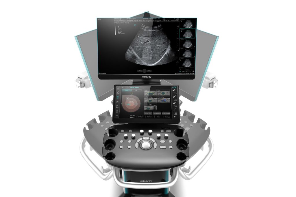 Mindray Consona N6 Ultrasound System - Best Quality in Bangladesh