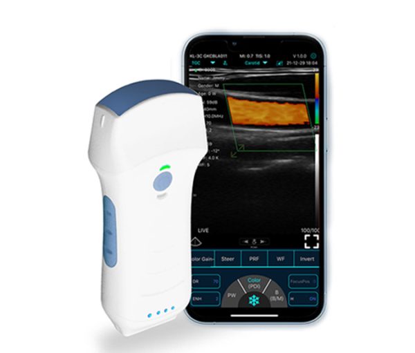 Dual-Probes Multipurpose Wireless Ultrasound - Convex + linear ...